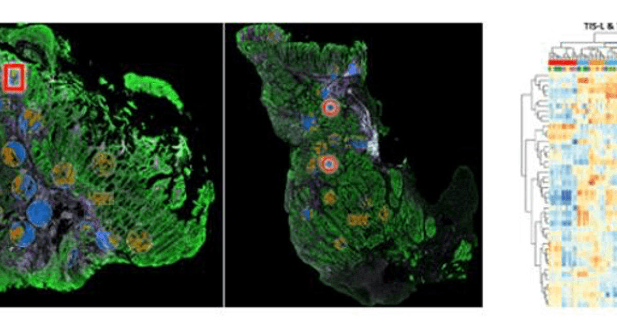 Illumina | Nanostring GeoMx® Digital Spatial Profiling with DRAGEN:…