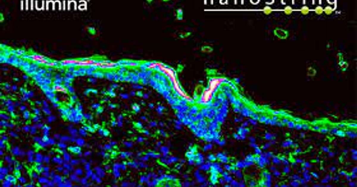 Illumina | Spatial Proteogenomics NanoString GeoMx® Digital Spatial…